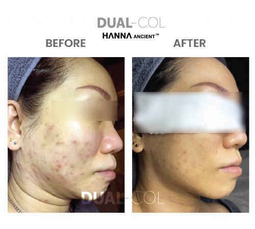 【Bundle Set】HANNA ANCIENT - Dual-Col Collagen Peptide Tablets【60 ...